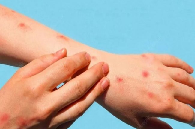 Domates Gribi Nedir, Nasıl Bulaşır ve Belirtileri Nelerdir? - Yaşadıkça